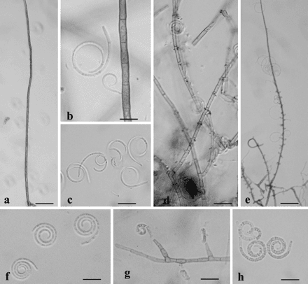 Types of Home Fungal in Fargo, ND - Fungal Glossary | Nordic Inspections